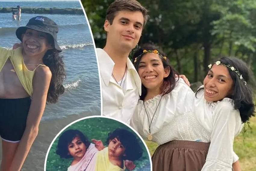 Así es la vida de Daniel, novio de siamesa que comparte pelvis con su ...