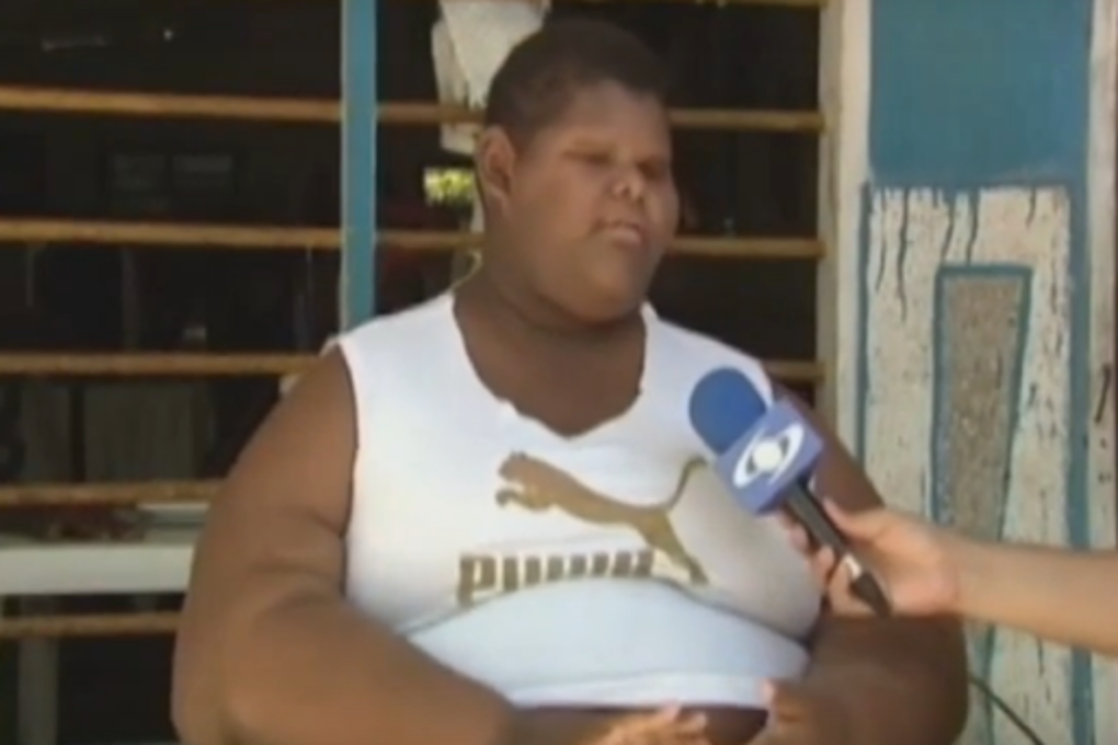 Conoce al hombre más obeso de Colombia, él sólo tiene 14 años