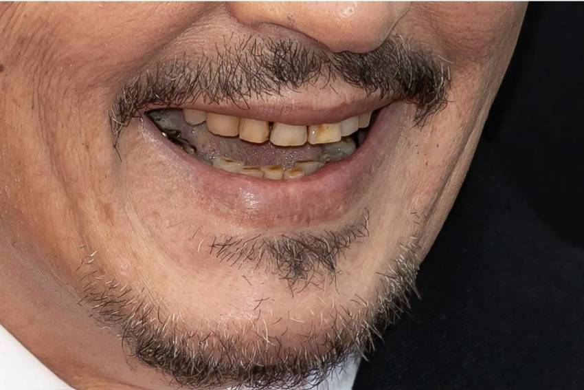 Los dientes de Johnny Depp generan debate entre sus fans, tras ...